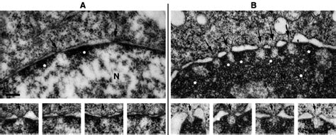 Electron Microscopy Of Nuclear Envelope And Nuclear Pores Of Uninfected