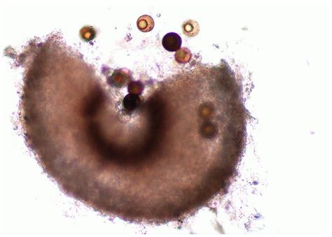 Hydroxy Proline And Gamma Aminobutyric Acid Markers Of Susceptibility To Vine Decline Disease