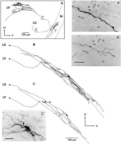A Tracer Filled Rt Neuron With Two Axons Which Were The Continuation
