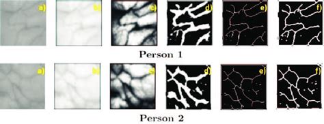 A Original Image B Spatial Filtering Chistogram Equalized D Download Scientific Diagram