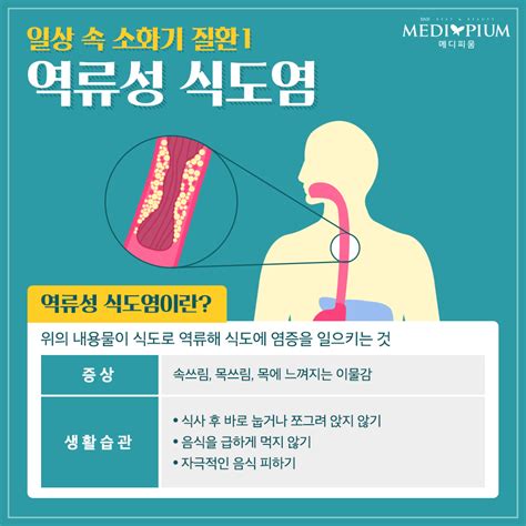 메디피움 일상에서 쉽게 넘길 수 있는 소화불량 소화기질환의 신호일 수 있습니다 메디피움에서 자주