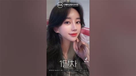 눈매교정뒤트임복코성형이중턱 수술 후기 Shorts Youtube