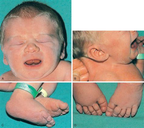 Human Birth Defects Clinical Tree