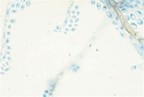 Exam 4 Mycology Images Dematiaceous Fungi Flashcards Quizlet