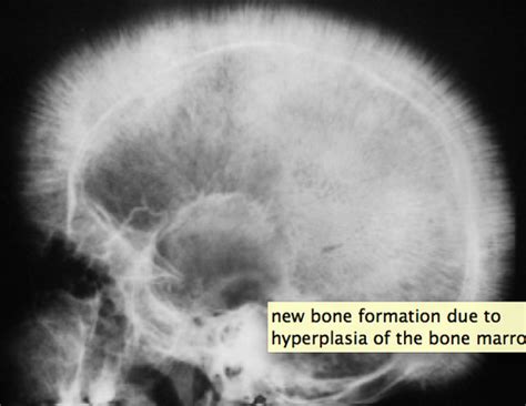 Module Pathophys Flashcards Quizlet