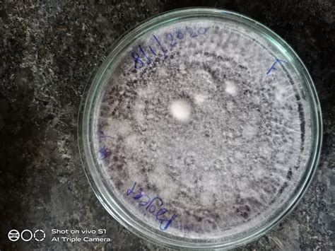 13 Questions With Answers In Bacterial Typing Techniques Science Topic