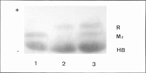 Pyruvate Kinase Pk Isozyme Cellulose Acetate Electrophoresis With Download Scientific Diagram