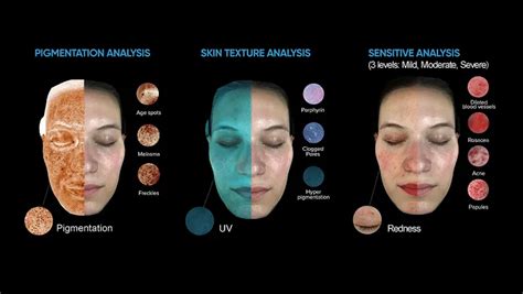 Ai Skin Analysis 3d Skin Analyzer And Scans Vcare Coe