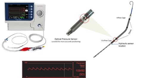Abiomed Impella Opsens Medical