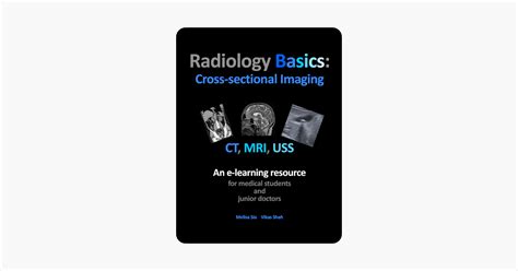 ‎radiology Basics Cross Sectional Imaging On Apple Books