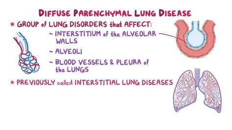 What Is A Lung Parenchyma At Sophia Wiseman Blog