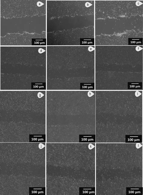 Wound Scratch Images A Untreated Cells At 0 H B Sa1 At 0 H C Sam2 At