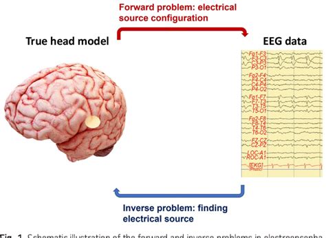 Pdf Understanding The Usefulness Of Electroencephalography Source