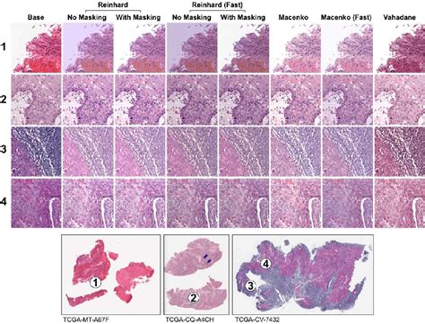 Figure 8 From Slideflow Deep Learning For Digital Histopathology With Real Time Whole Slide