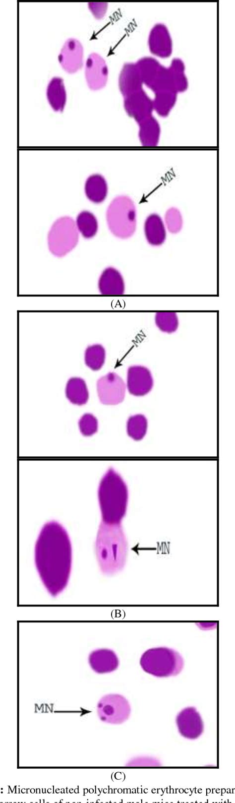 Polychromatic Erythrocyte