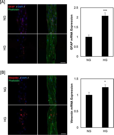 Glial Fibrillary Acidic Protein Gfap And Vimentin Expression Analysis Download Scientific