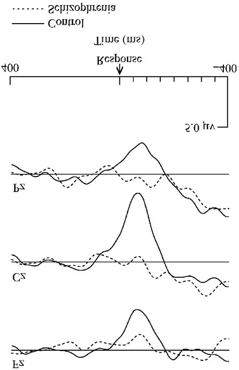 Difference Waves Between Response Locked Event Related Brain Potentials Download Scientific
