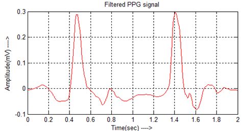 noise free and baseline drift removed ppg signal using wavelet db4