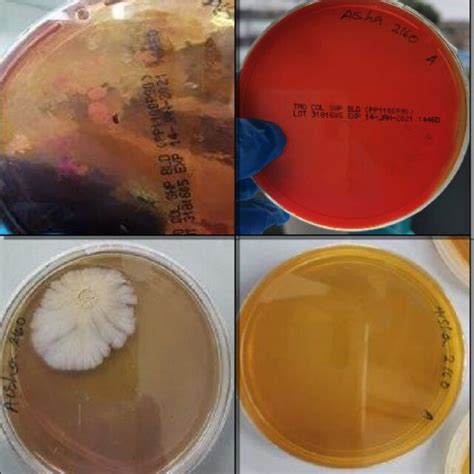 Microbial Contamination Screening Of Non Sterilized And Download