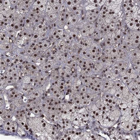 Rabbit Polyclonal Anti Dmap1 Antibody Buy For Research Highly
