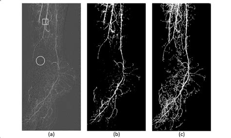 A User Initialization Regions Of Interest At Vessel In Rectangle And Download Scientific