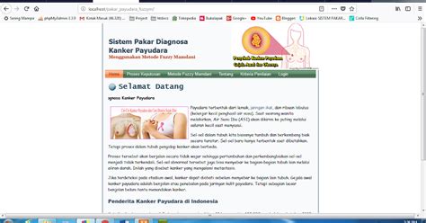 Piramida Skripsi Sistem Pakar Diagnosa Kanker Payudara Metode Fuzzy Mamdani PHP MySQL