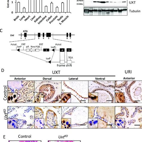 Uxt Ablation In The Mouse Prostate Resulted In Pin Different Mouse Download Scientific Diagram