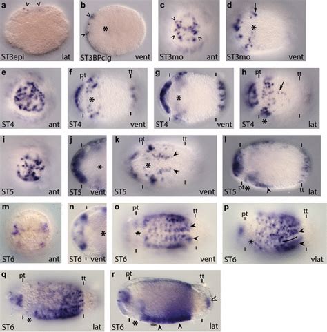 Ct Pros Is Expressed In Single Cells Throughout The Ectoderm And