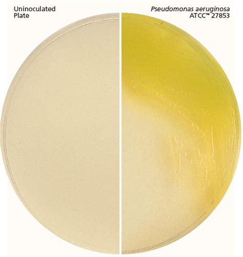 Pseudomonas Isolation Agar Interlab