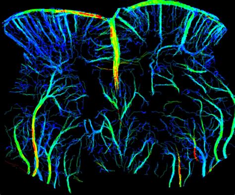 Super Resolution Ultrasound Through Sparsity Based Deconvolution And