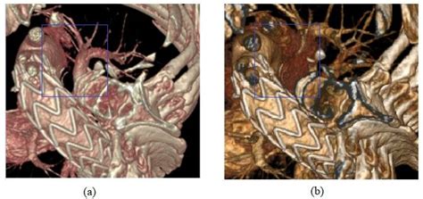 The Comparison Result Of Volume Rendering Where A Based On Our