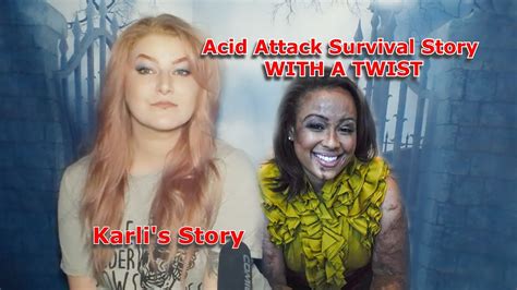 Karlis Survival Story Of 2 Acid Attacks True Crime If You See Something Say Something