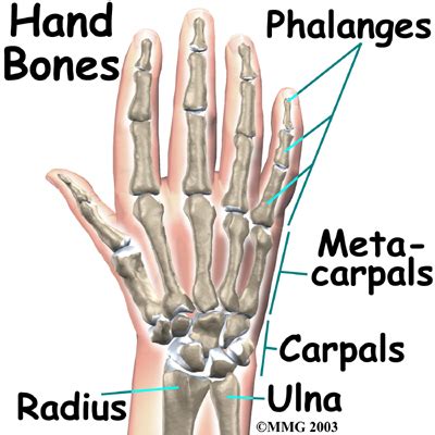 Finger Joint Arthritis