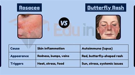 Difference Between Autonomic And Somatic Reflexes