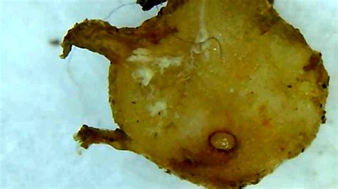 Dandelion Nodules And Nodule Cross Sections Under Magnification Free