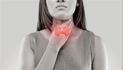 Multiple Thyroid Nodules Icd 10 Humanhairfashion