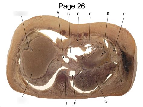 Page 26 Structures Diagram Quizlet