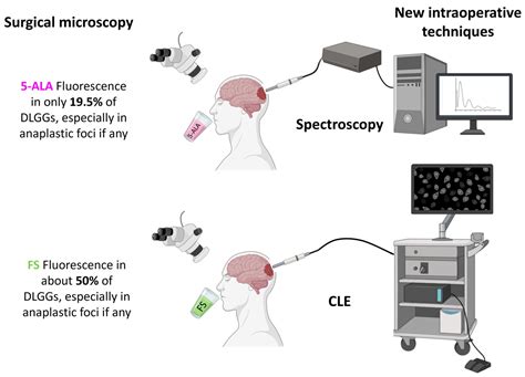 Fluorescence Guided Surgical Techniques In Adult Diffuse Low Grade