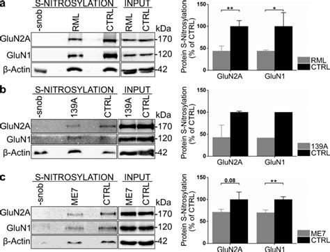 S Nitrosylation Of Nmdar Subunits In Hippocampi Of Control And