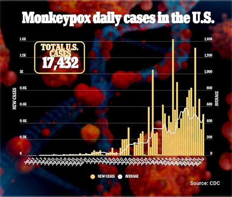 New York City reports first monkeypox infection in juvenile, health department reveals | Daily ...