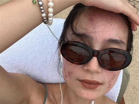Terpopuler Sepekan Wajah Tatjana Saphira Tanpa Makeup Pd Pamer Jerawat