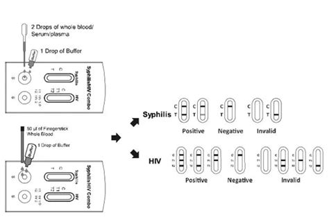 Syphilis Test Wholesale Supplier Jcmed