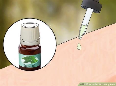 4 Ways To Get Rid Of Bug Bites WikiHow