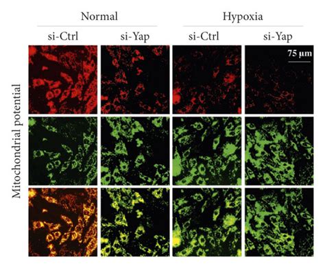 Yap Knockdown Reduces Mitochondrial Function In Hypoxia Treated Breast Download Scientific