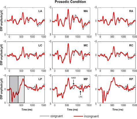 Erp Average Waveforms For Prosodic Condition Erp Average Waveforms Are