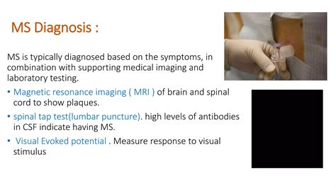 Multiple Sclerosis Pathophysiology Diagnosis And Treatment Pptx