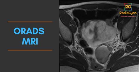 Orads Mri