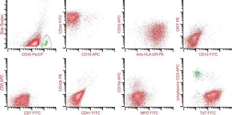 Acute Leukemias Of Ambiguous Lineage Clinical Tree