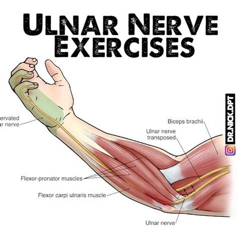 Ulnar Nerve Combined Exercises Artofit