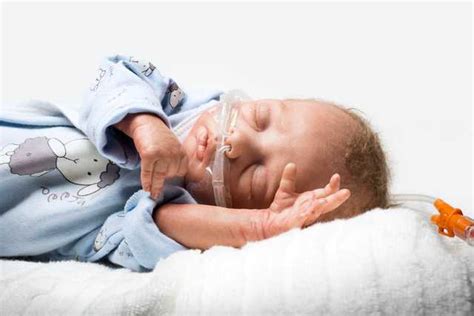 Hamilton T1 Neonatal Ventilator For Transport Hamilton Medical